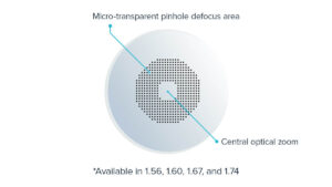Myopia Management with MyoEase and MyOnic | Opticare